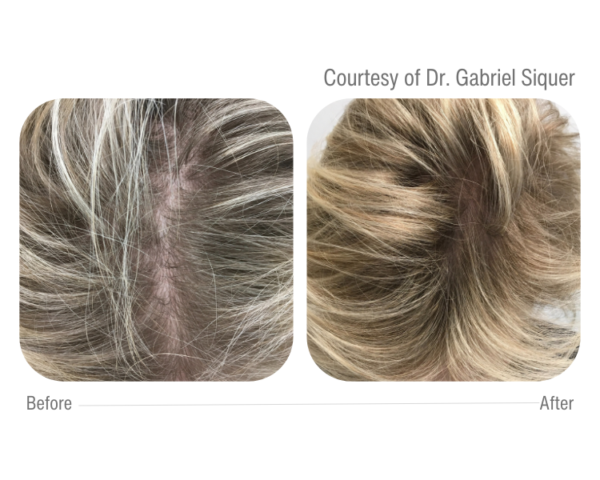 CELLBOOSTER® HAIR - Suisselle