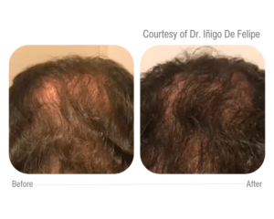 CELLBOOSTER® HAIR - Suisselle