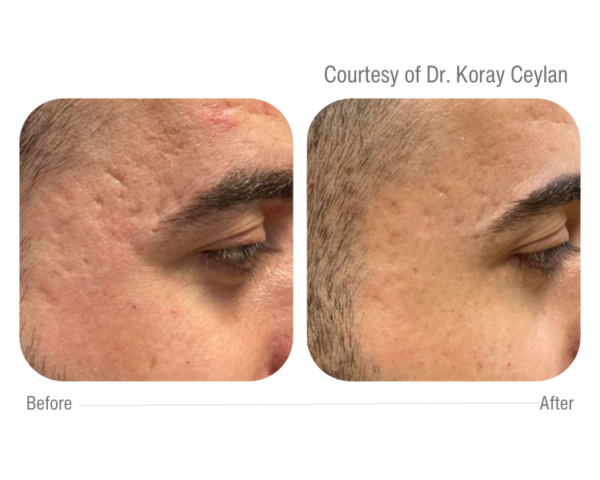 CELLBOOSTER® LIFT - Suisselle