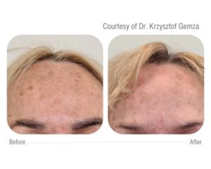 CELLBOOSTER® GLOW - Suisselle