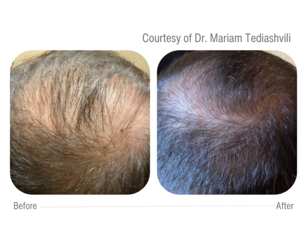 CELLBOOSTER® HAIR - Suisselle