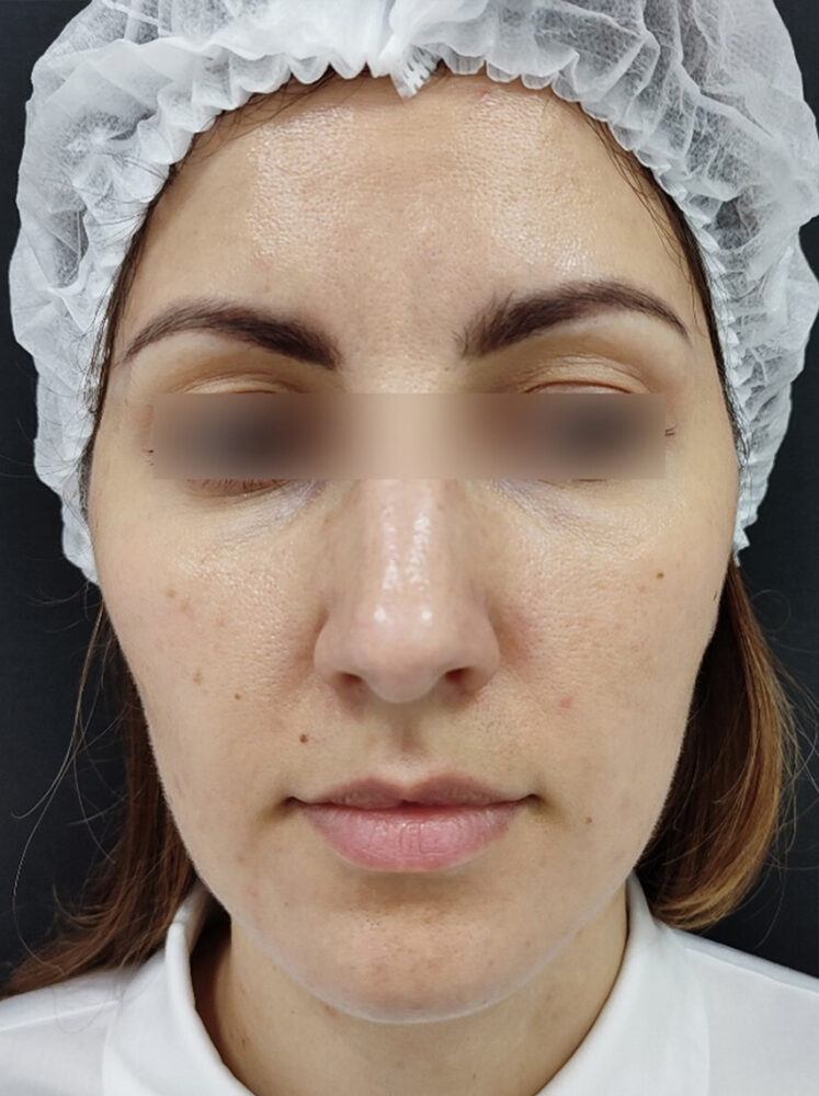 CELLBOOSTER® GLOW - Suisselle