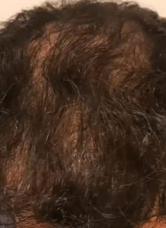 CELLBOOSTER® HAIR - Suisselle